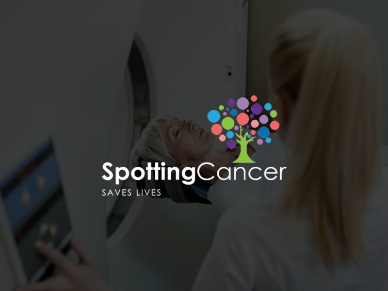 5 Step Spotting Cancer Plan - Spotting Cancer