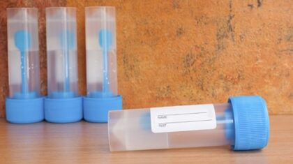 Screening & Testing For Early Cancer Detection: Stool Test - Spotting ...